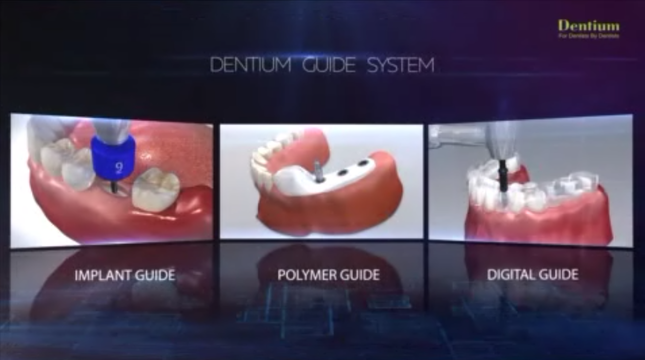Dentium Digital Guide