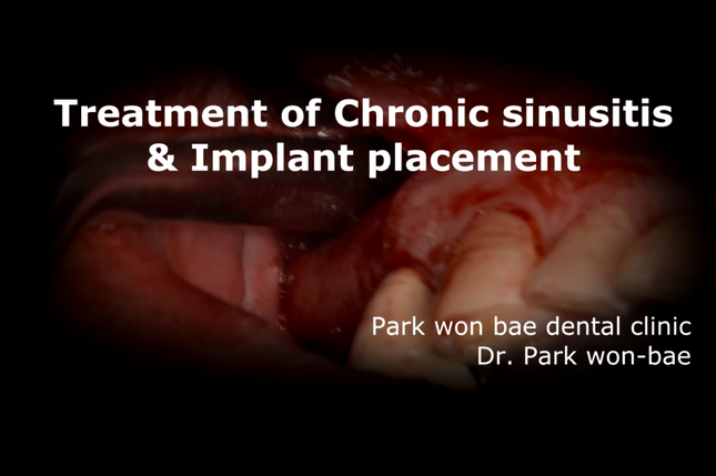 Caldwell-Luc operation and Sinus elevation_Dr.Won-Bae Park